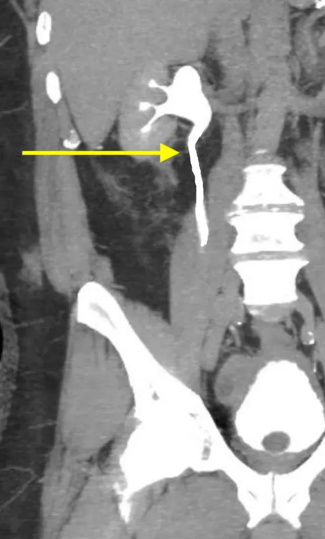 Urologic Reconstructive Surgery - Gregory Amend, MD