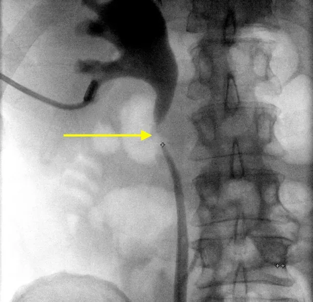 Urologic Reconstructive Surgery - Gregory Amend, MD